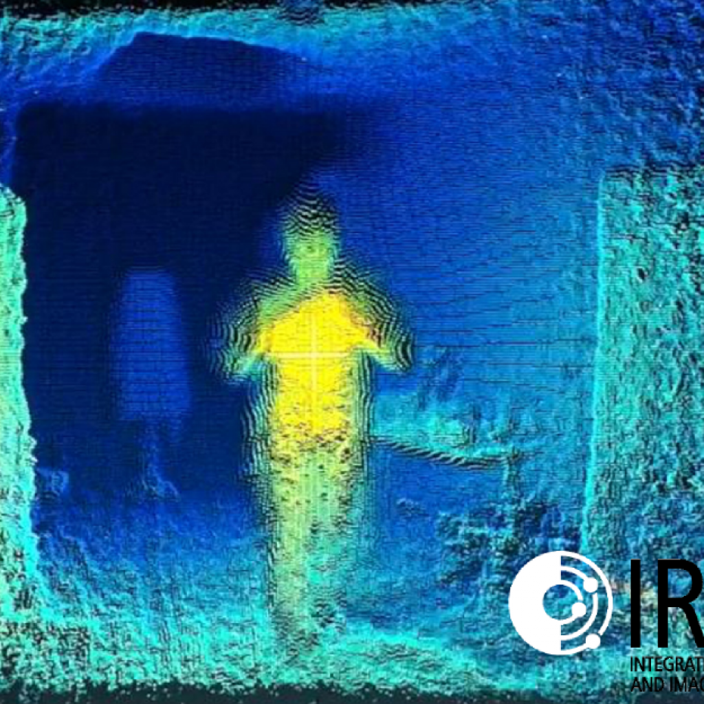 IRIS – Integrated Readout ASICs and Image Sensors - FBK: SD