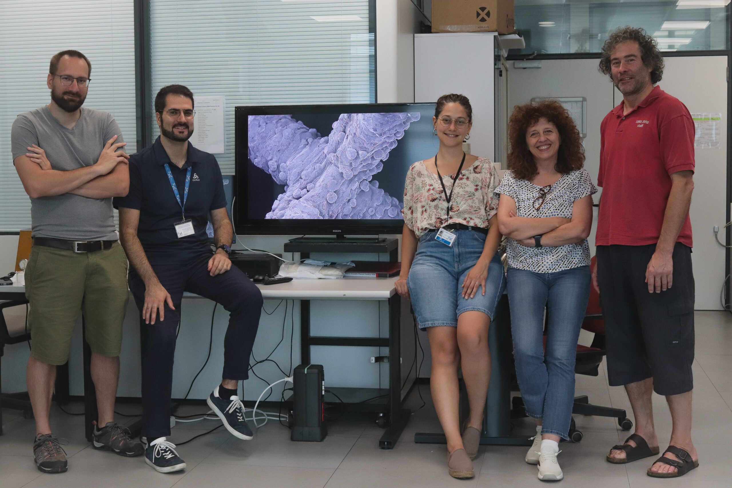 Electron microscopy in FBK and beyond - FBK: SD